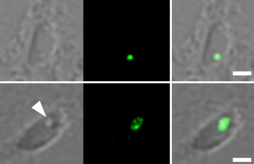 EPIC researchers gain ground in the race to cure widespread parasitic ...