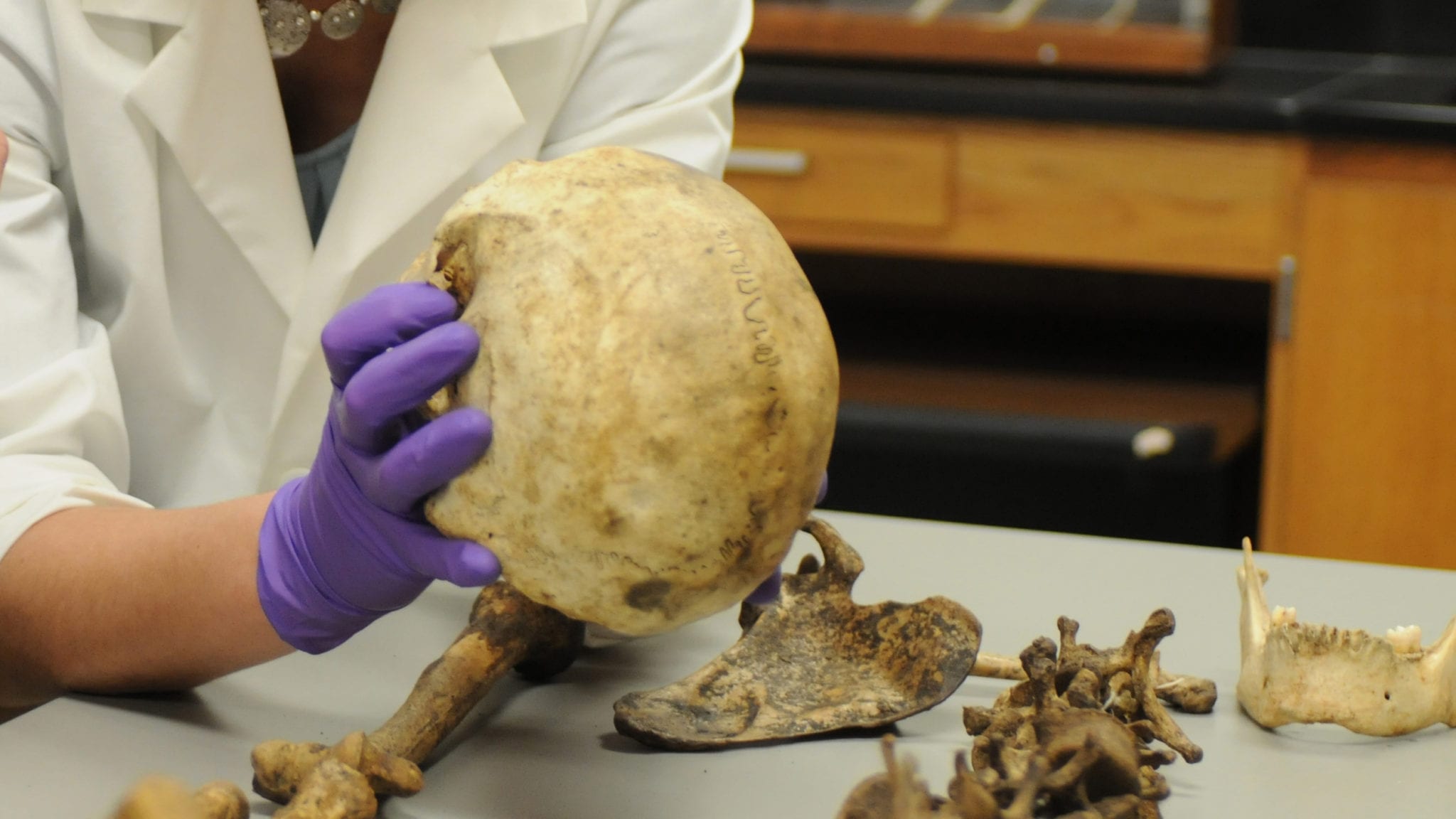 Forensic anthropologists work to identify human skeletal remains and ...